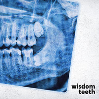 Wisdom Teeth Songs Download: Play & Listen Wisdom Teeth all MP3 Song by ...