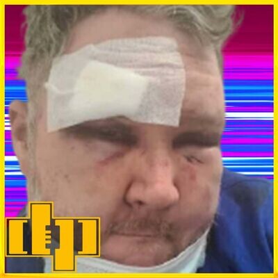 Ethan Ralph's Face REARRANGED - Milo Vs Pokémon - The Creation of NEW ...